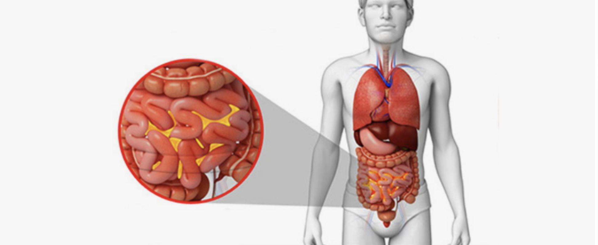 Peritonit (Batın İçi Enfeksiyon) Nedir? - Prof. Dr. Mustafa Özateş