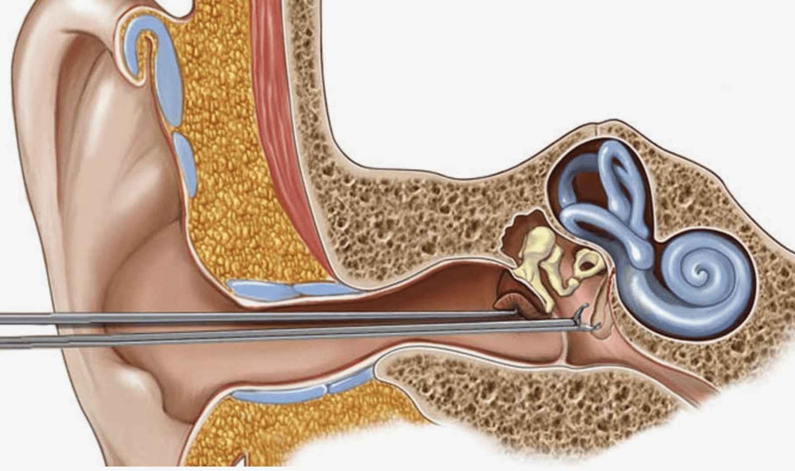 Kulak Emarı Nedir? - Prof. Dr. Mustafa Özateş